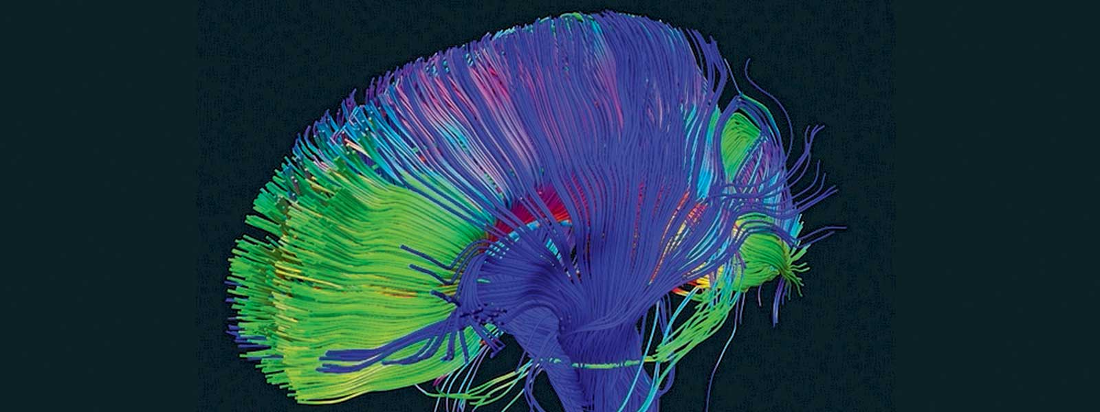 Brain and Body Imaging Research Center | Binghamton University